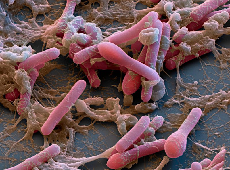 Ботулизм – бактериальная инфекция